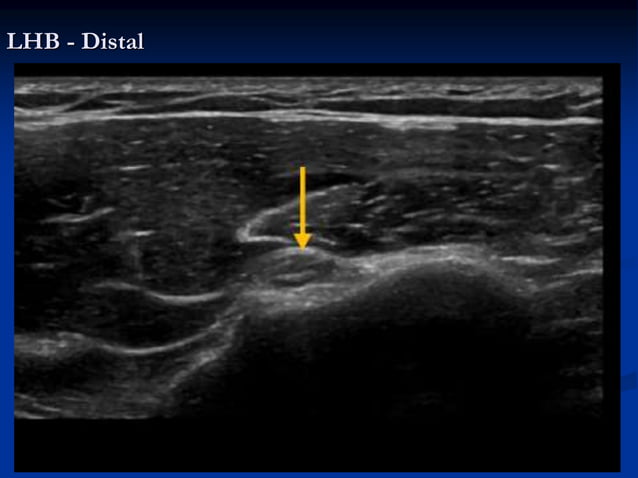 Post-graduate Certifcate Musculoskeletal Ultrasound - The Shoulder | PPT