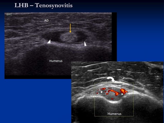 Post-graduate Certifcate Musculoskeletal Ultrasound - The Shoulder | PPT