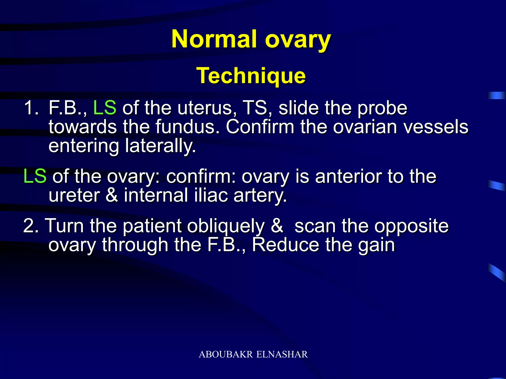 Ultrasonography of the ovary | PDF