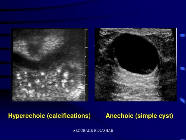 Ultrasonography of the ovary