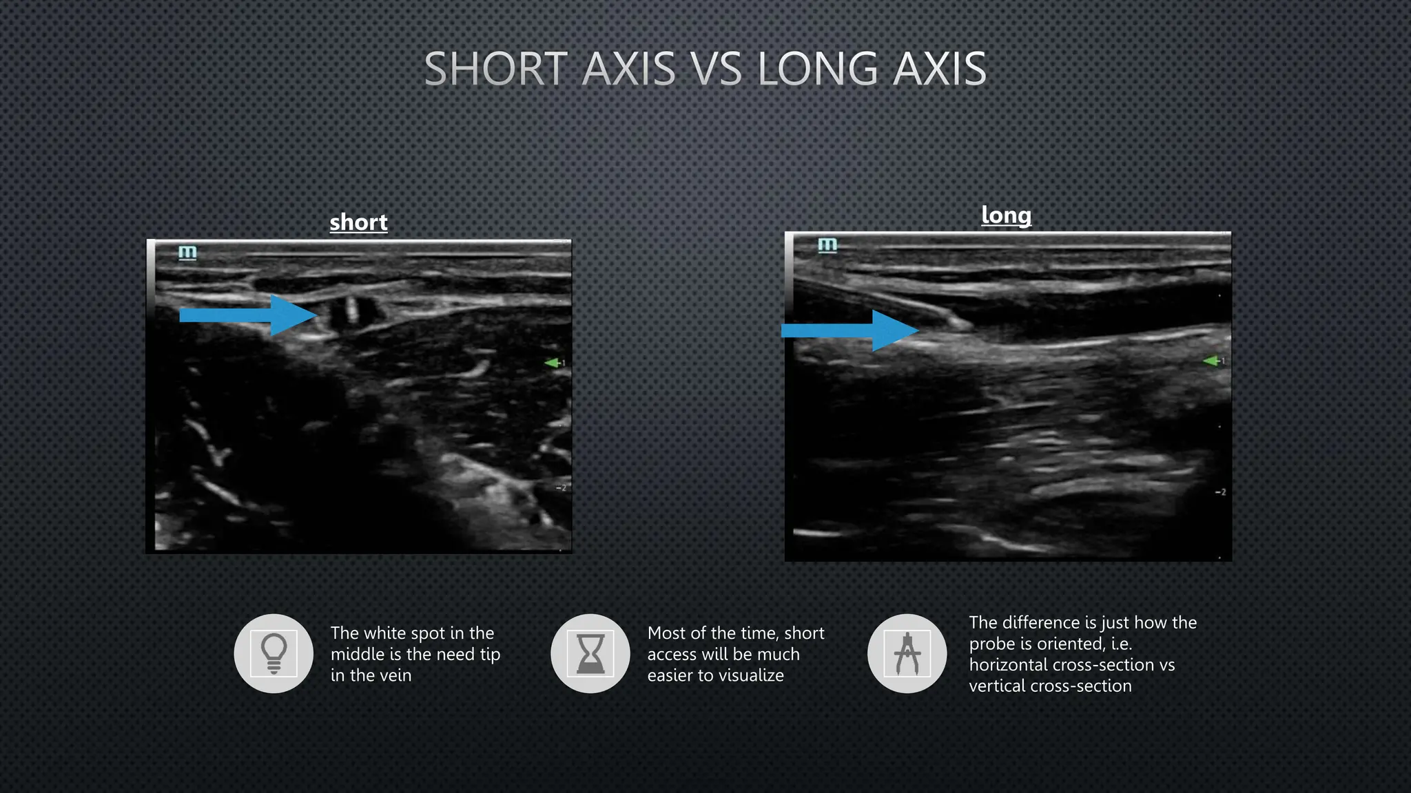 Peripheral IV placement under ultrasound guidance | PPTX
