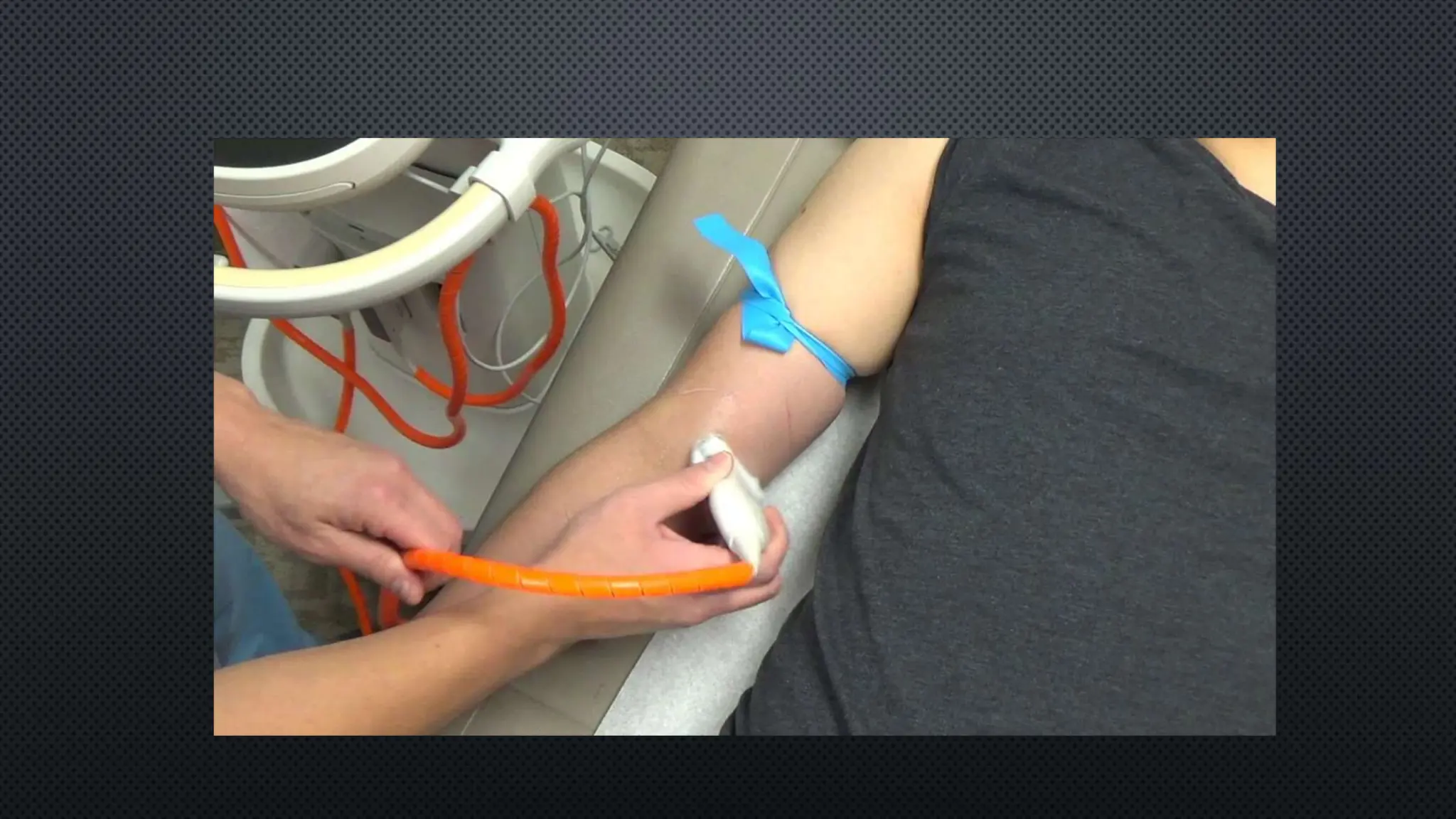 Peripheral IV placement under ultrasound guidance | PPTX