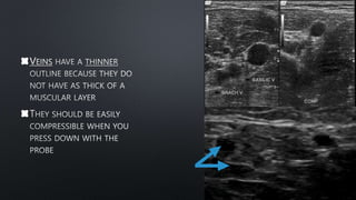 Peripheral IV placement under ultrasound guidance | PPTX