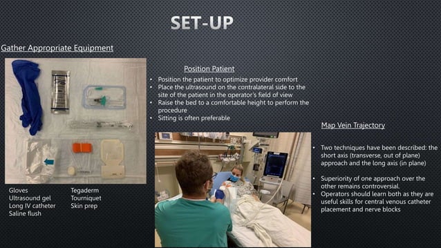 Peripheral IV placement under ultrasound guidance | PPTX
