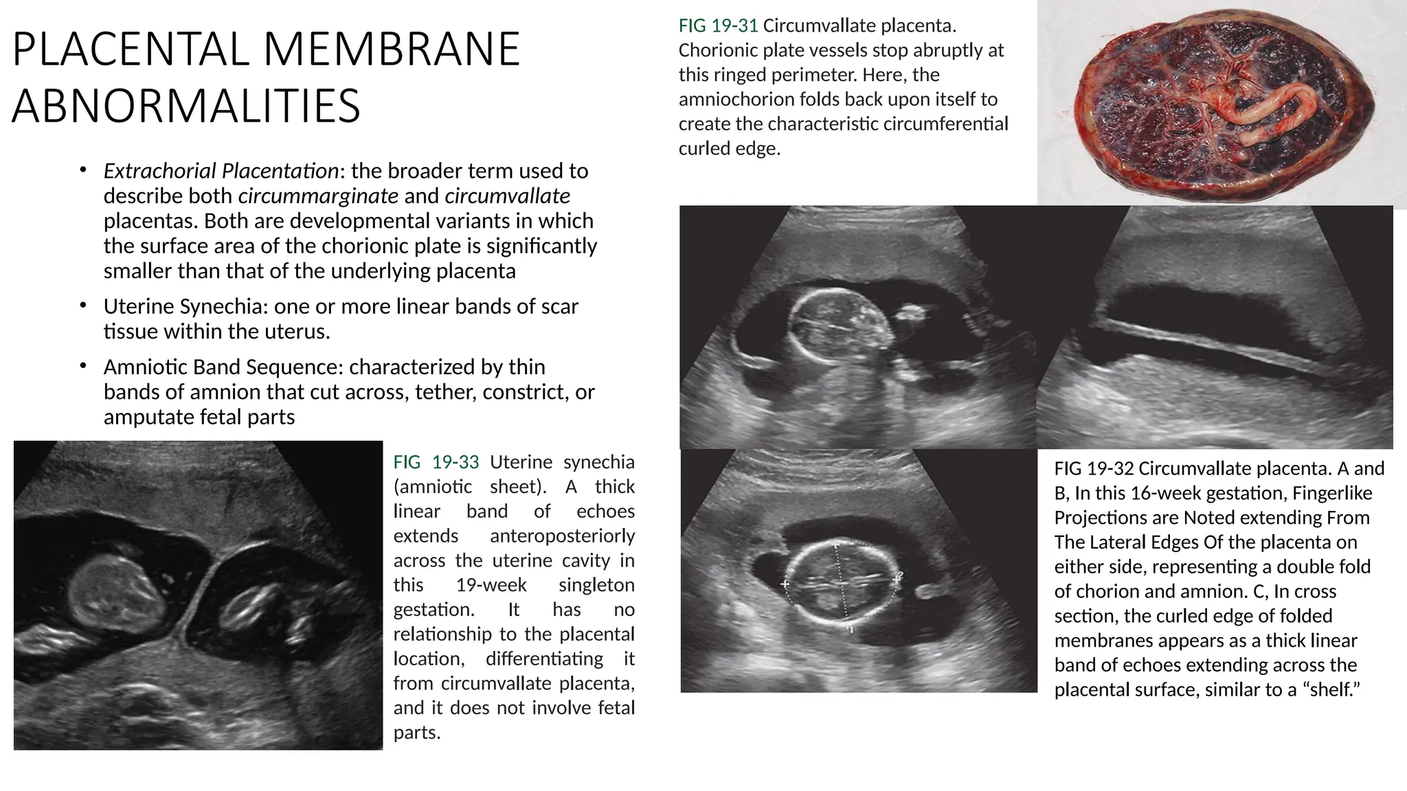 Ultrasound to evaluated placenta ASW.pptx
