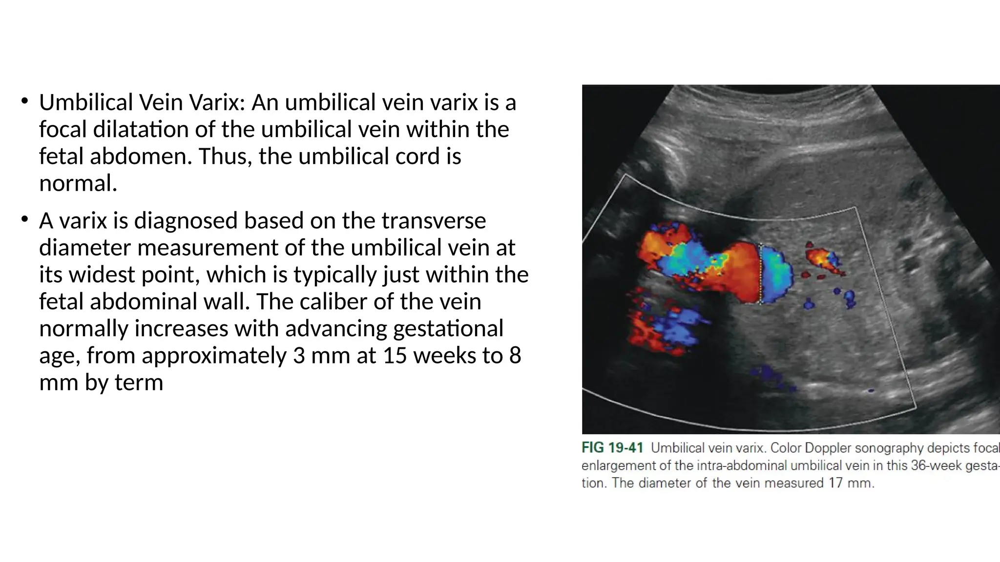 Ultrasound to evaluated placenta ASW.pptx