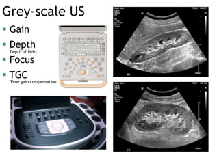 Us renal and lower urinary tract for beginners kim sh 20190617 | PPT