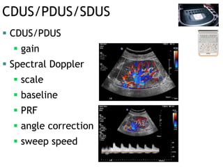 Us renal and lower urinary tract for beginners kim sh 20190617 | PPT