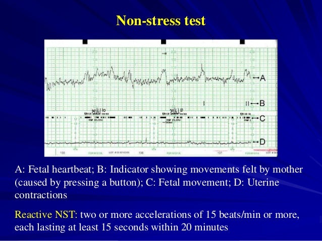 Ultrasound screening in pregnancy