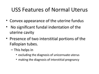 USS in Ectopic Pregnancy | PPT