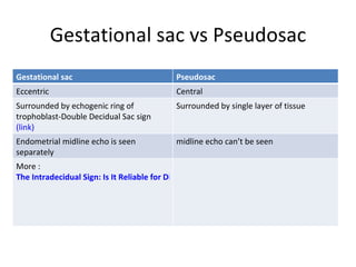 USS in Ectopic Pregnancy | PPT
