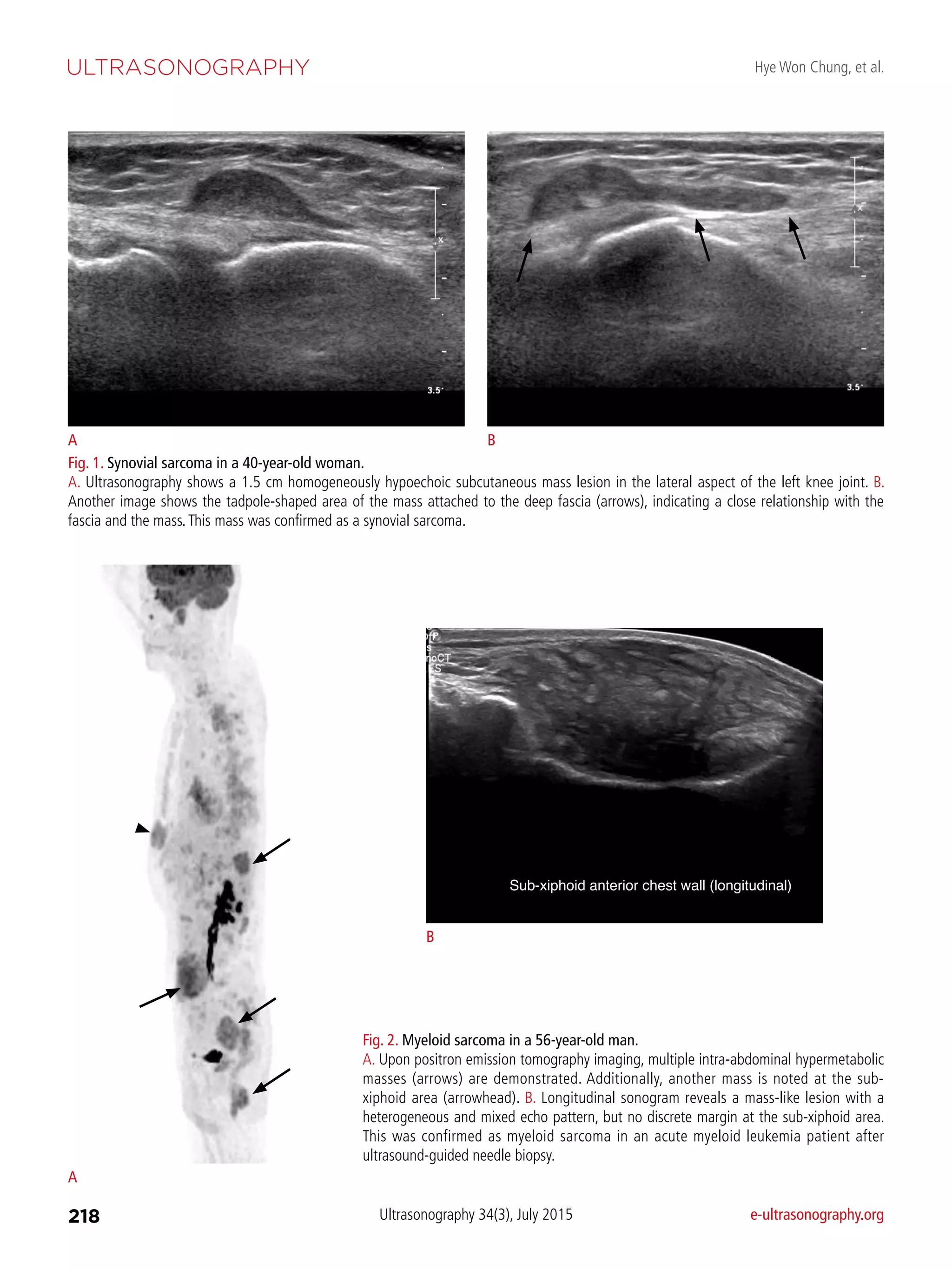 Diagnostic Ultrasound soft tissue | PDF