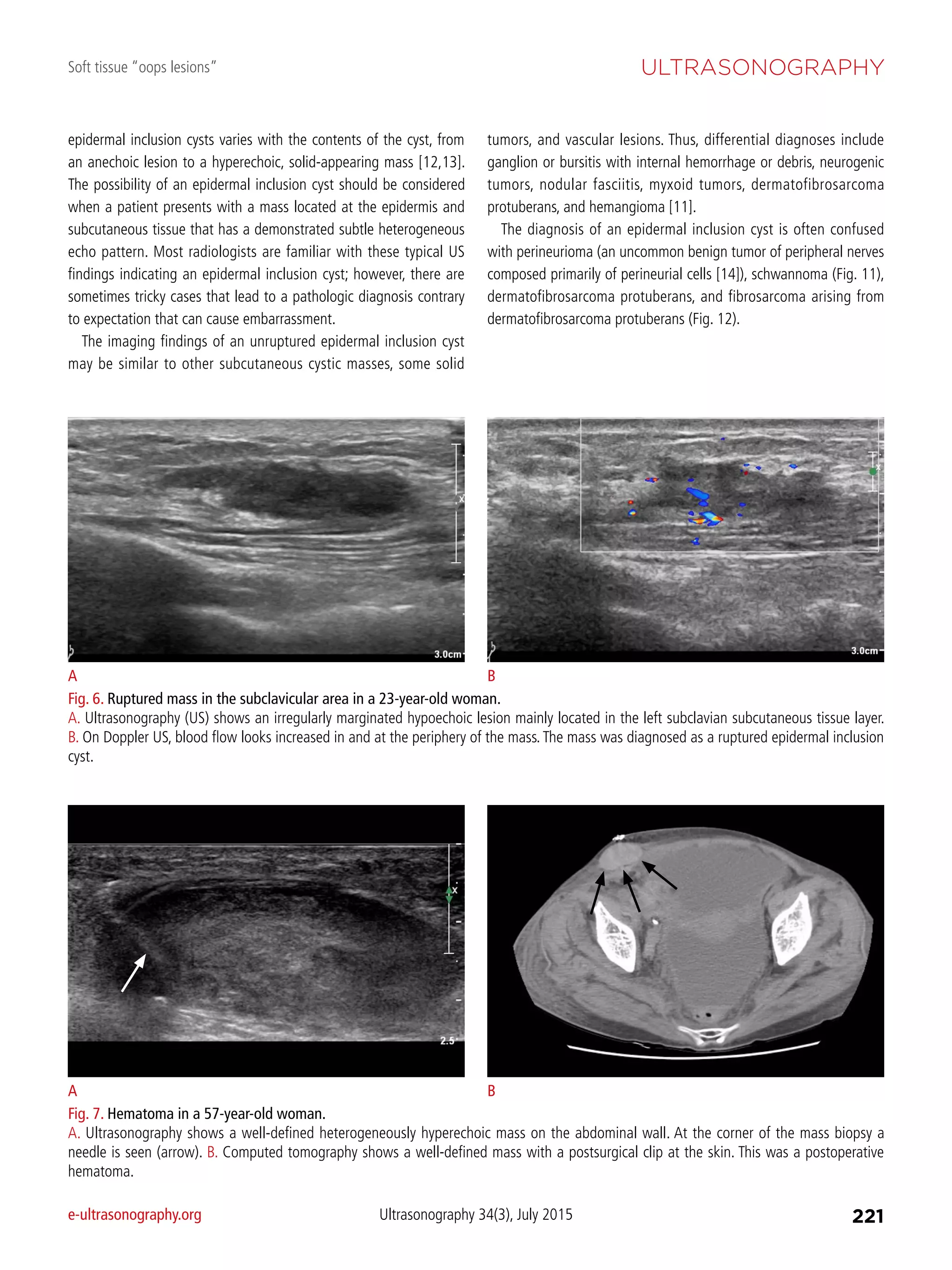 Diagnostic Ultrasound soft tissue | PDF