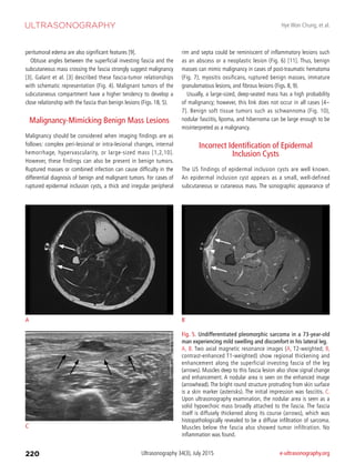 Diagnostic Ultrasound soft tissue | PDF