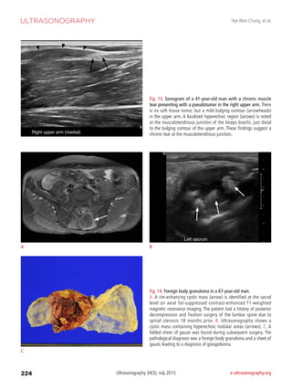 Diagnostic Ultrasound soft tissue | PDF