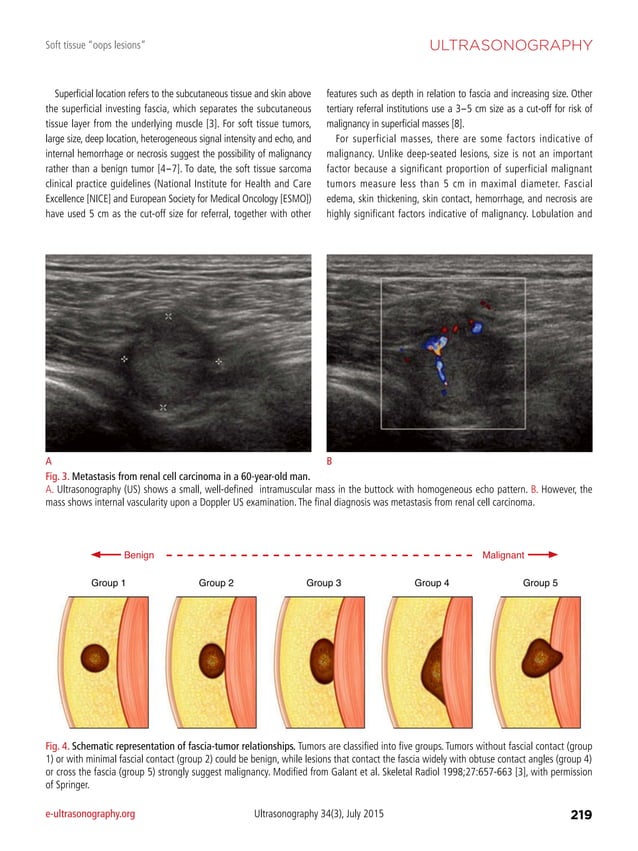 Diagnostic Ultrasound Soft Tissue