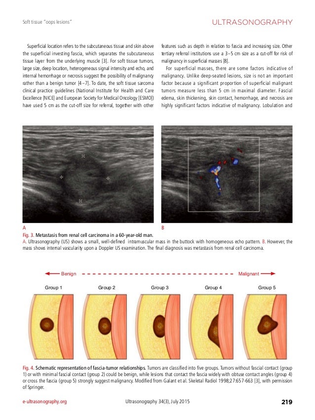 Diagnostic Ultrasound Soft Tissue