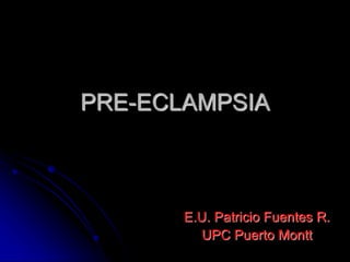 UST ECLAMPSIA.ppt