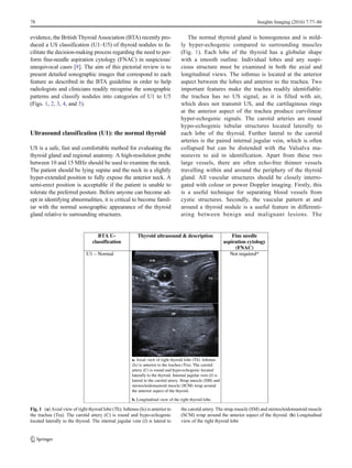 Ultrasound thyroid nodule | PDF