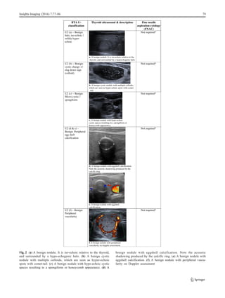 Ultrasound thyroid nodule | PDF
