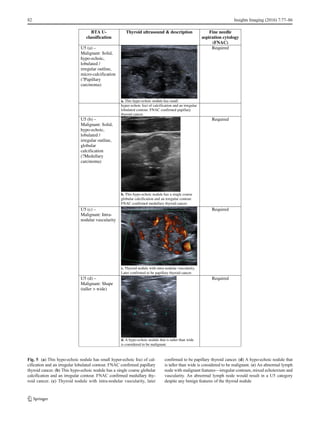Ultrasound thyroid nodule | PDF