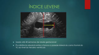 Ultrassonografia transfontanelar | PPT