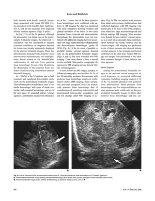 Us Transfontanelar Hemorragia | PDF
