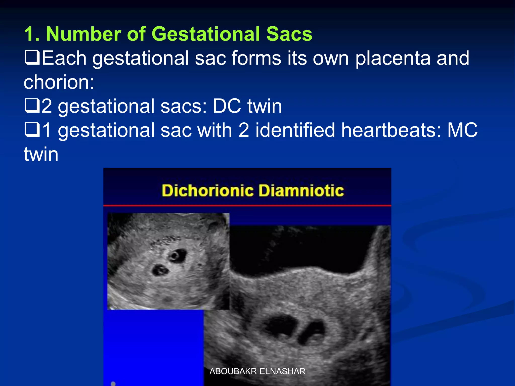 Ultrasonography of twin pregnancy SOGC GUIDELINE | PDF