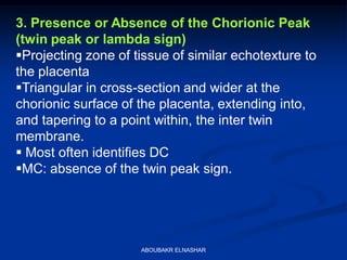 Ultrasonography of twin pregnancy SOGC GUIDELINE | PDF