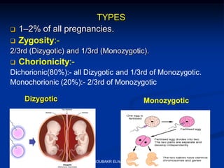 Ultrasonography of twin pregnancy SOGC GUIDELINE | PDF