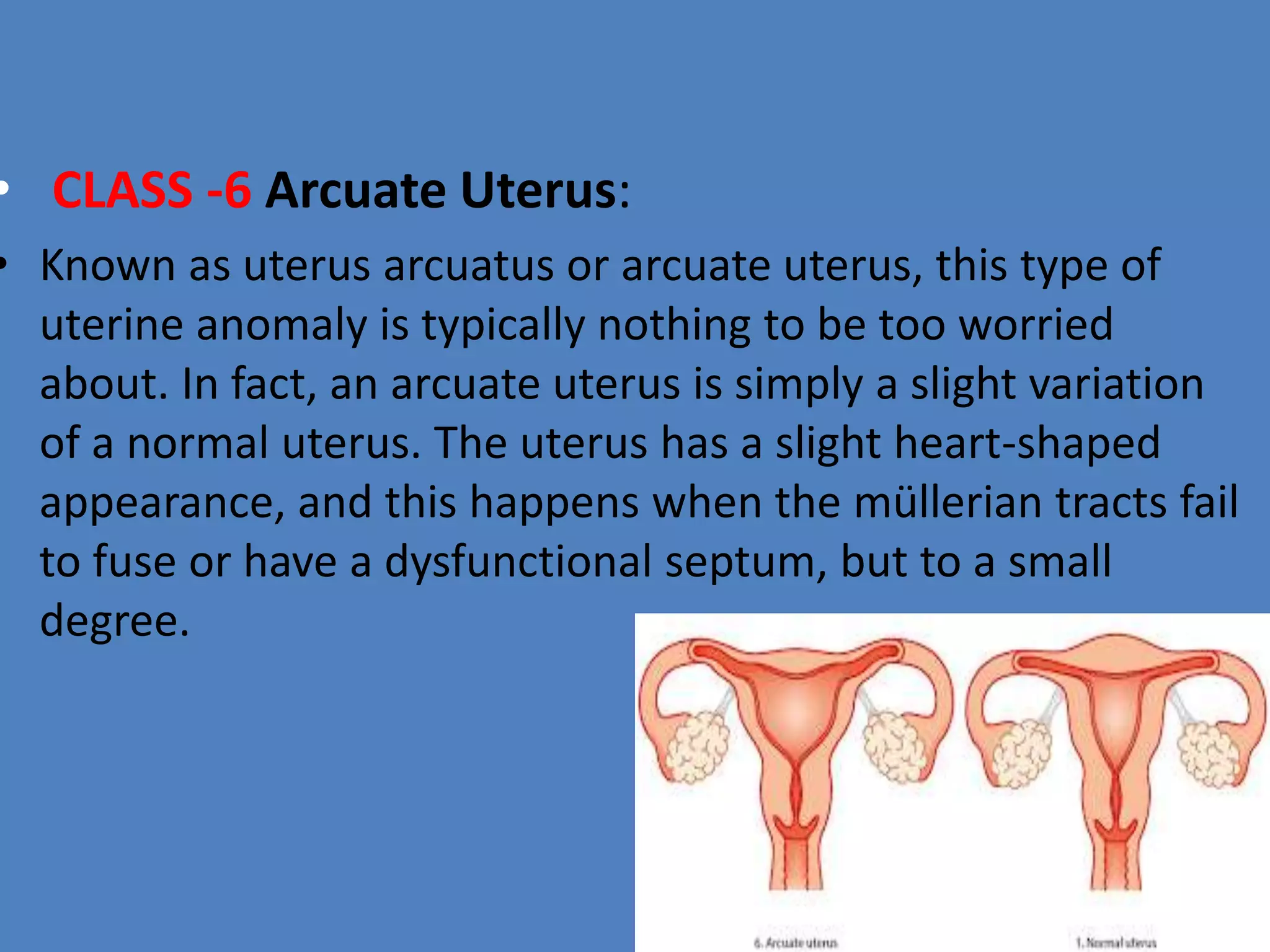 Uterine abnormalities | PPTX
