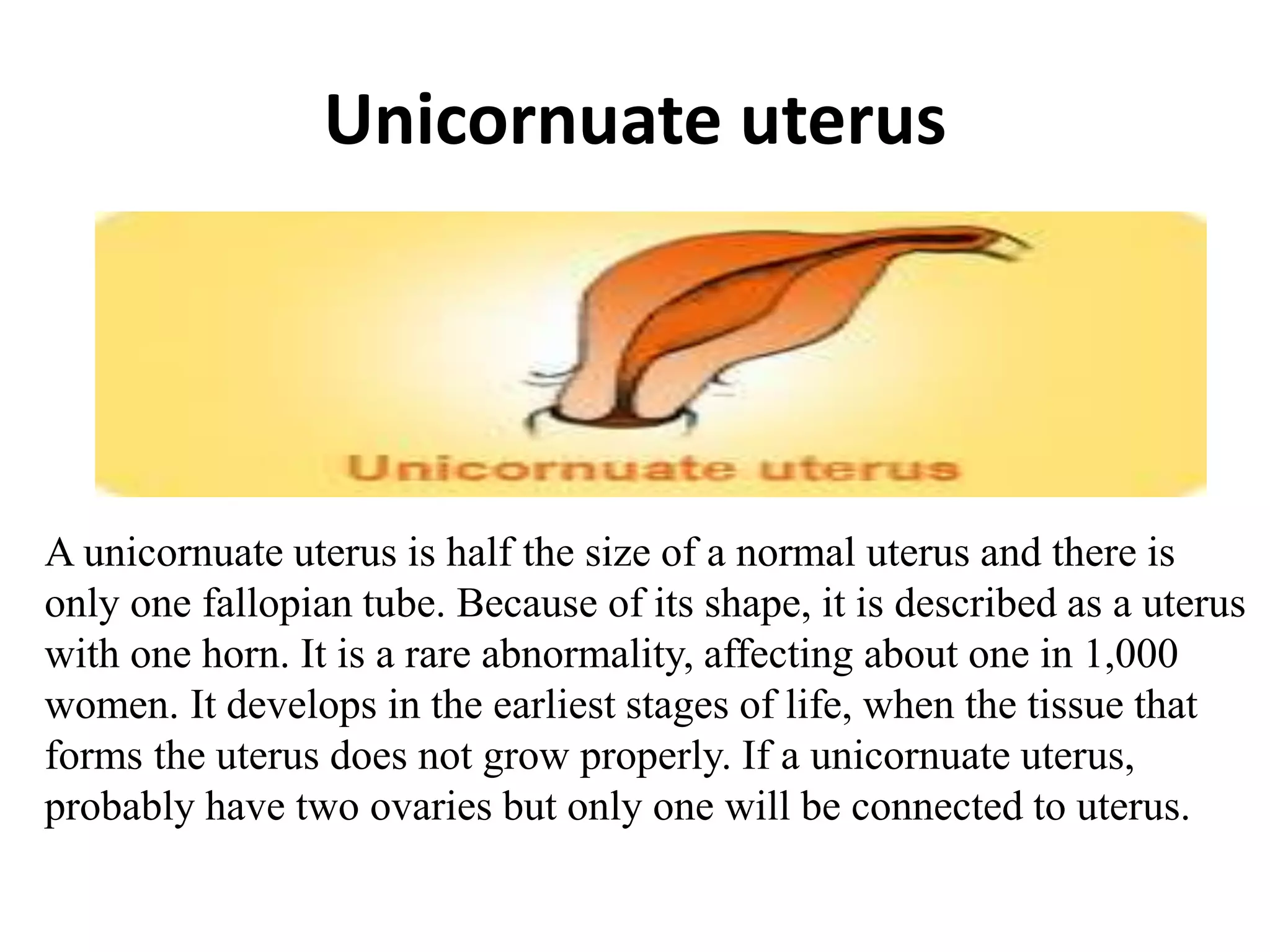 Uterine Abnormality.pptx