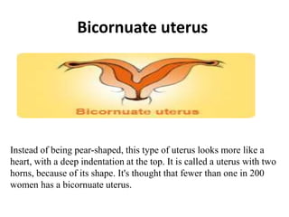 Uterine Abnormality.pptx