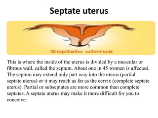 Uterine Abnormality.pptx