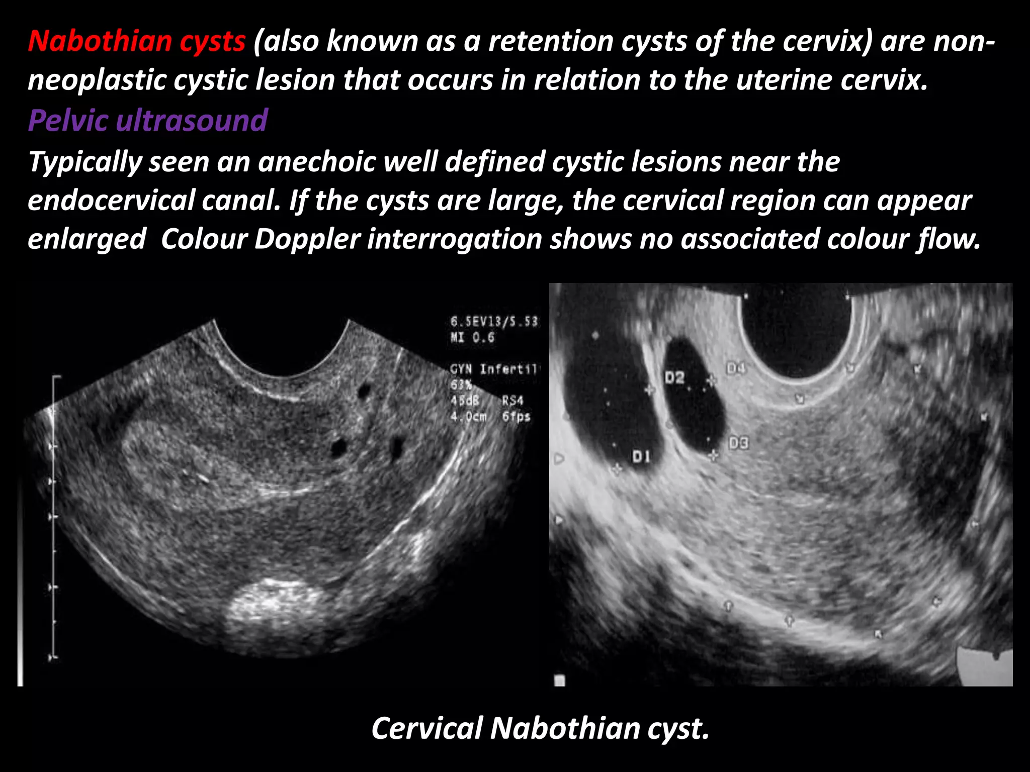 ULTRASOUND EXAMINATION OF Uterine and ovarian pathology by DR ABHIJIT R ...