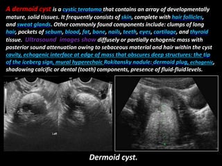 ULTRASOUND EXAMINATION OF Uterine and ovarian pathology by DR ABHIJIT R ...