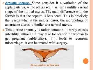Uterine anomalies | PPTX