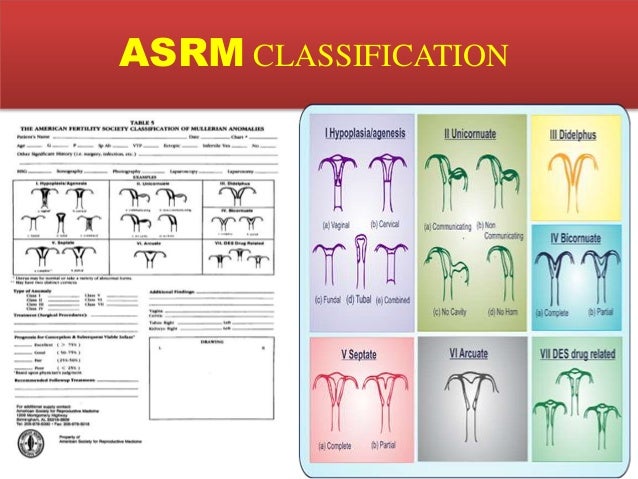 Uterine anomalies and reproductive outcomes