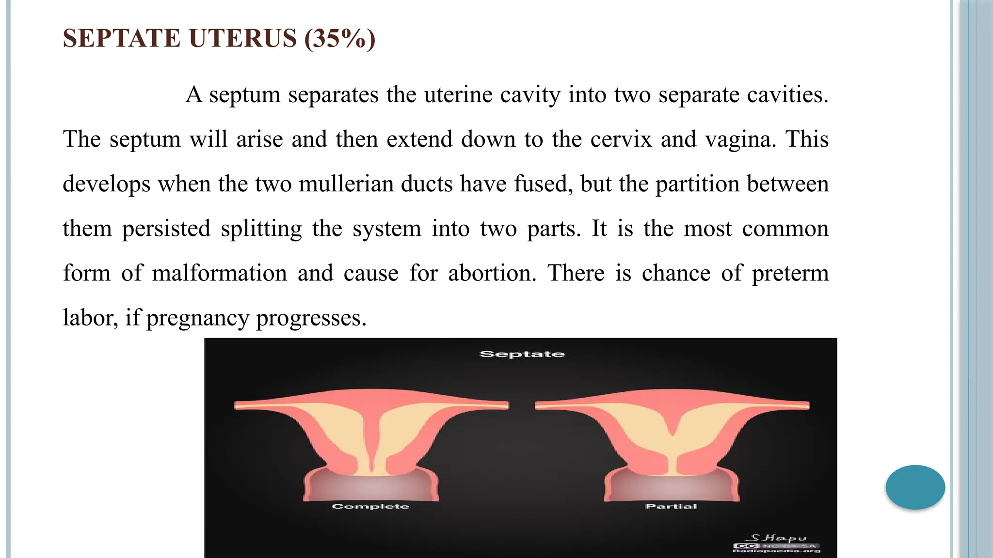 UTERINE anomalies,prolapse, ovarian cyst.pptx