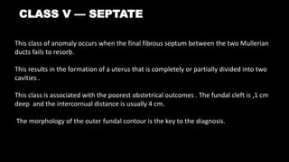 uterine anomaly UB.pptx