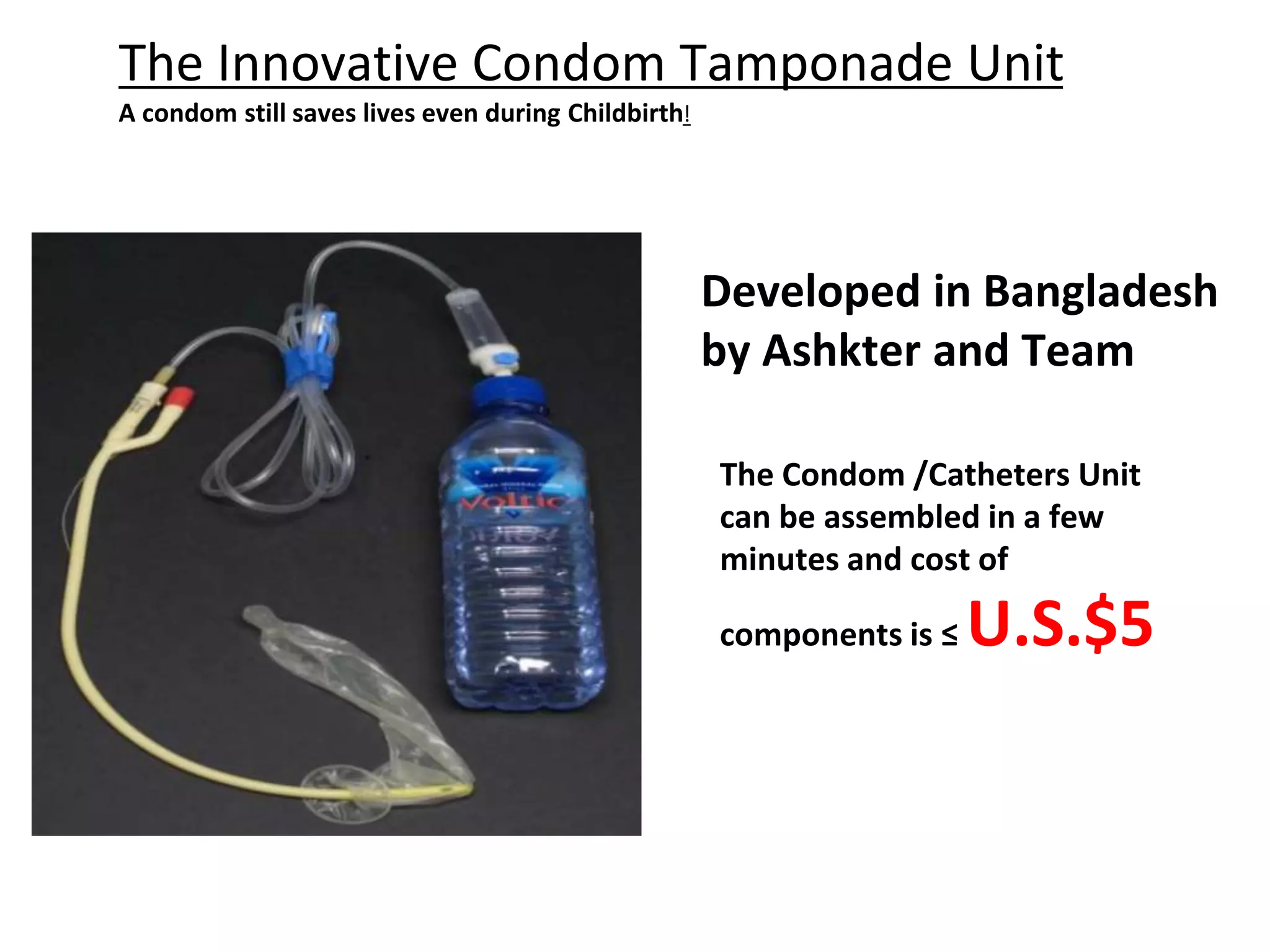 Uterine balloon tamponade in Postpartum Hemorrhage (PPH) | PPTX