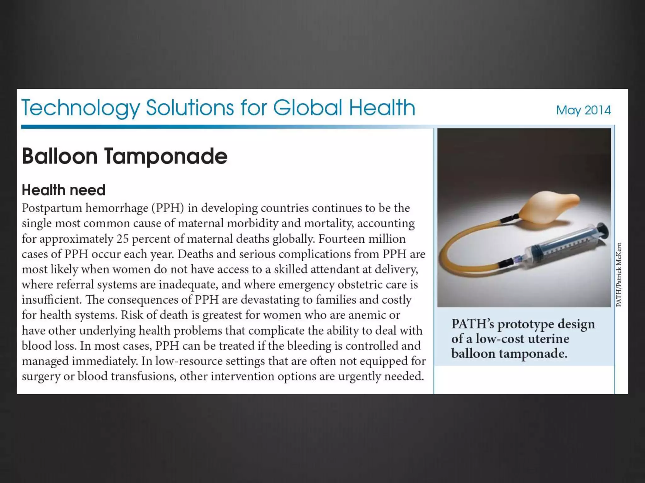 Uterine balloon tamponade in Postpartum Hemorrhage (PPH) | PPT Uterine balloon tamponade in Postpartum Hemorrhage (PPH) | PPT