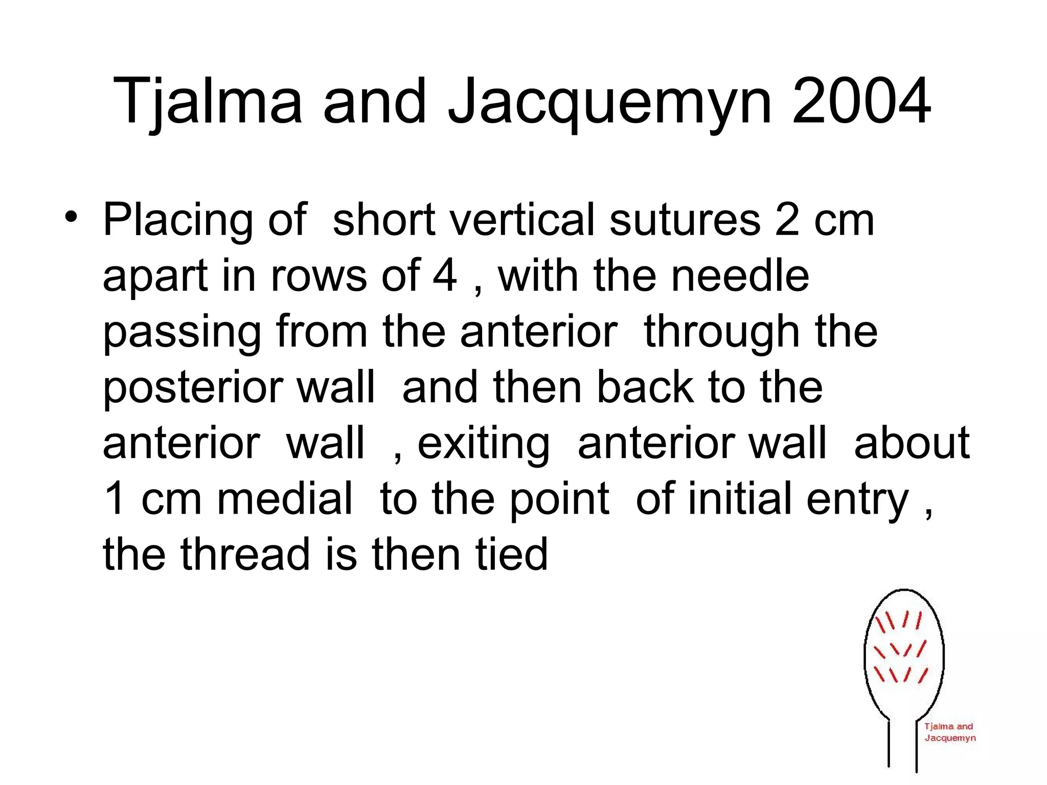 Uterine compression sutures | PPT