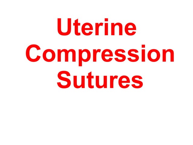 Uterine compression sutures | PPT