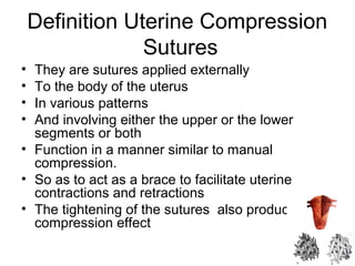 Uterine compression sutures | PPT