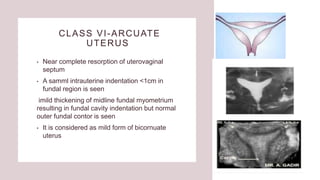 Uterine devlopment | PPT