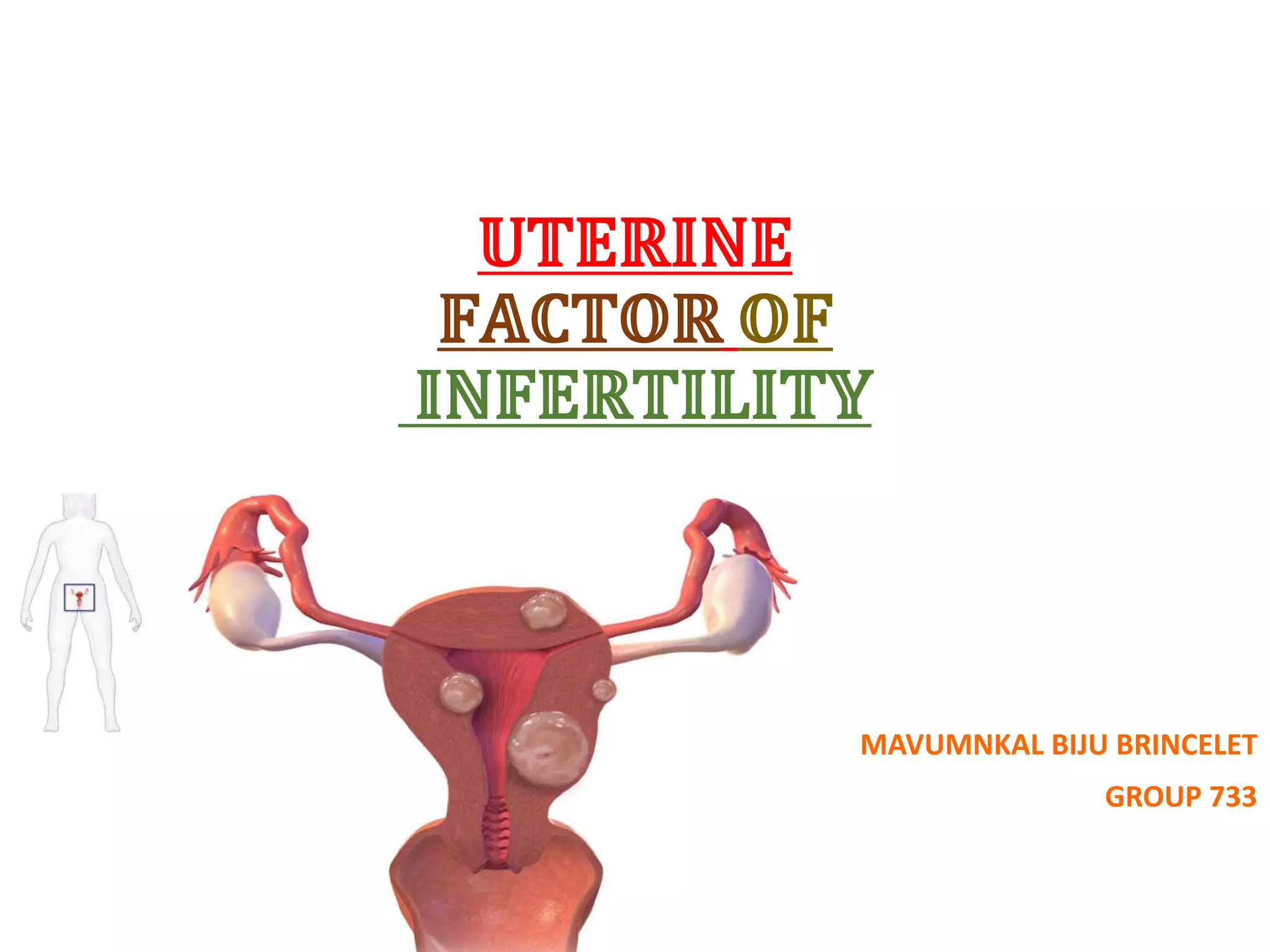 uterine factor of infertility, | PPTX