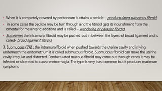 Uterine fibroid | PPTX