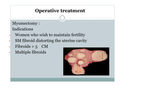 uterinefibroid gynaecology easy base of understanding | PPT
