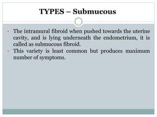Uterine fibroid | PPTX